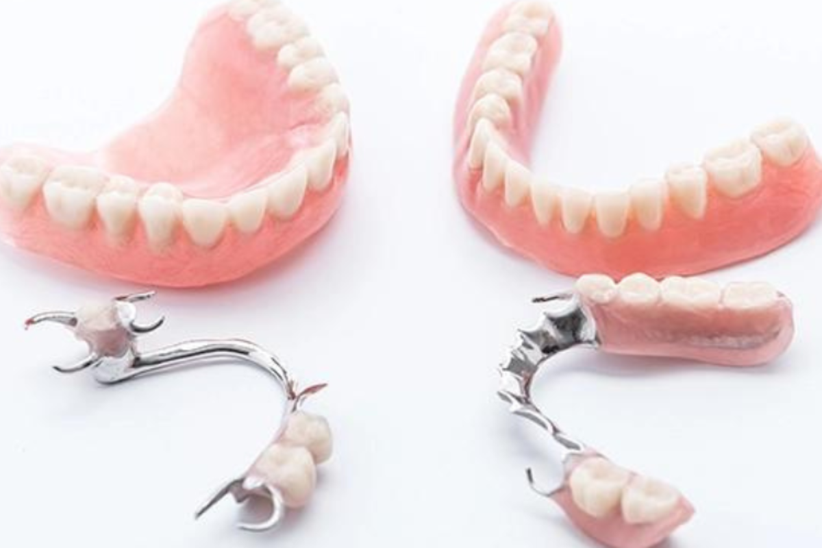 Full vs. Partial Dentures in Riverview, FL – Which Is Right for You?
